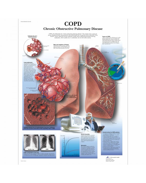 COPD Chart - Chronic Obstructive Pulmonary Disease